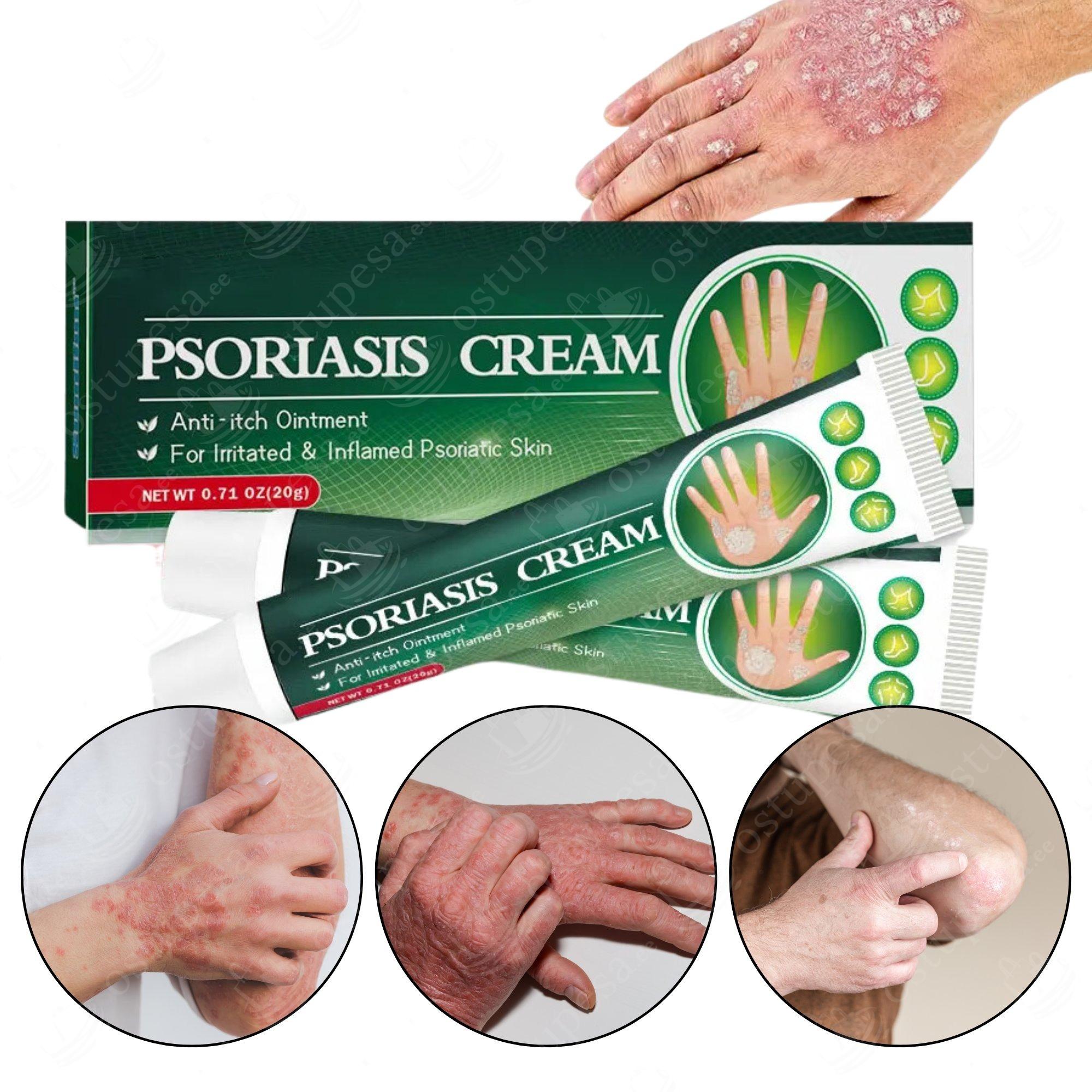 Psoriaasi kreem, 20 g, 2 tk komplektis - Ostupesa