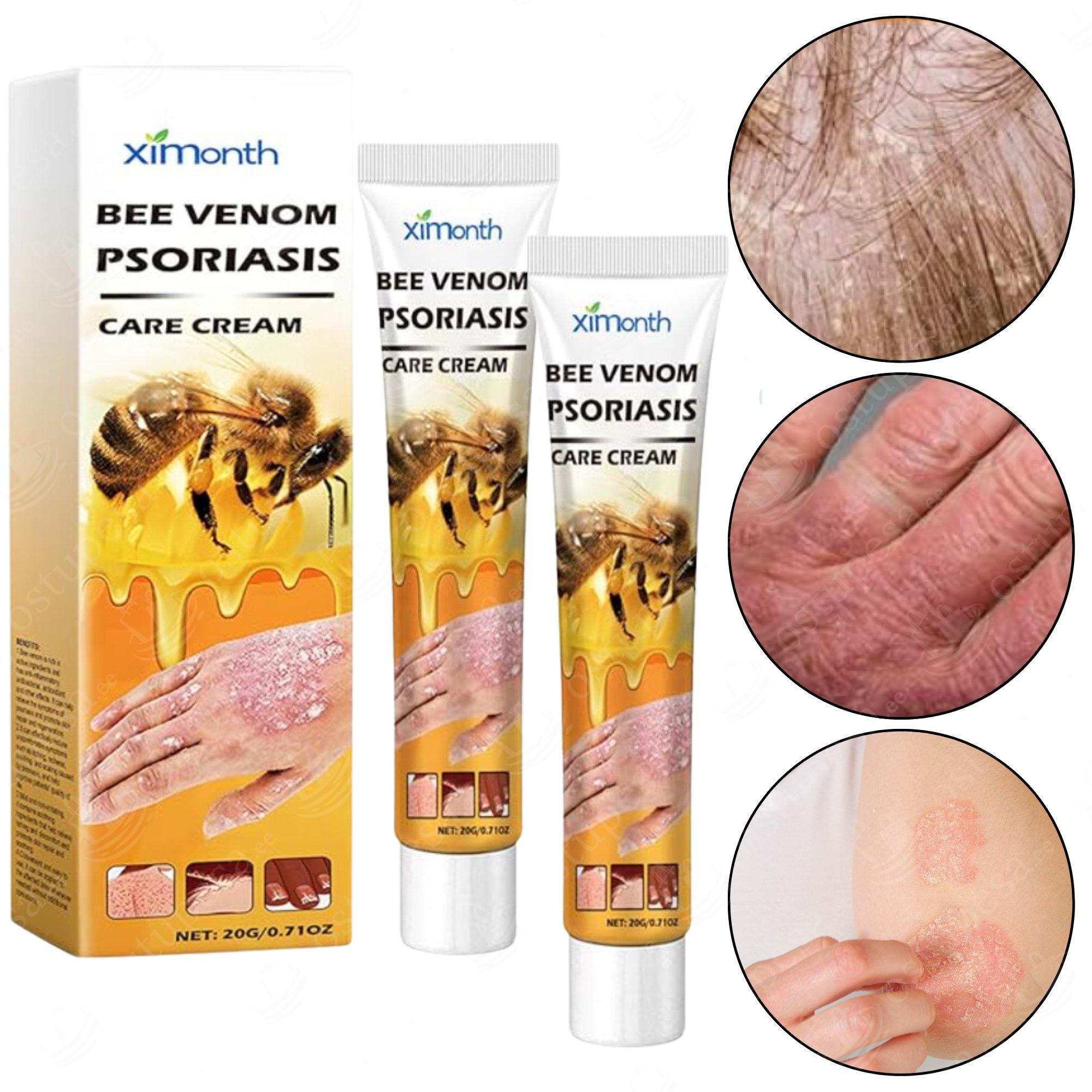 Psoriaasi kreem mesilasmürgiga, 20 g, 2 tk komplektis - Ostupesa